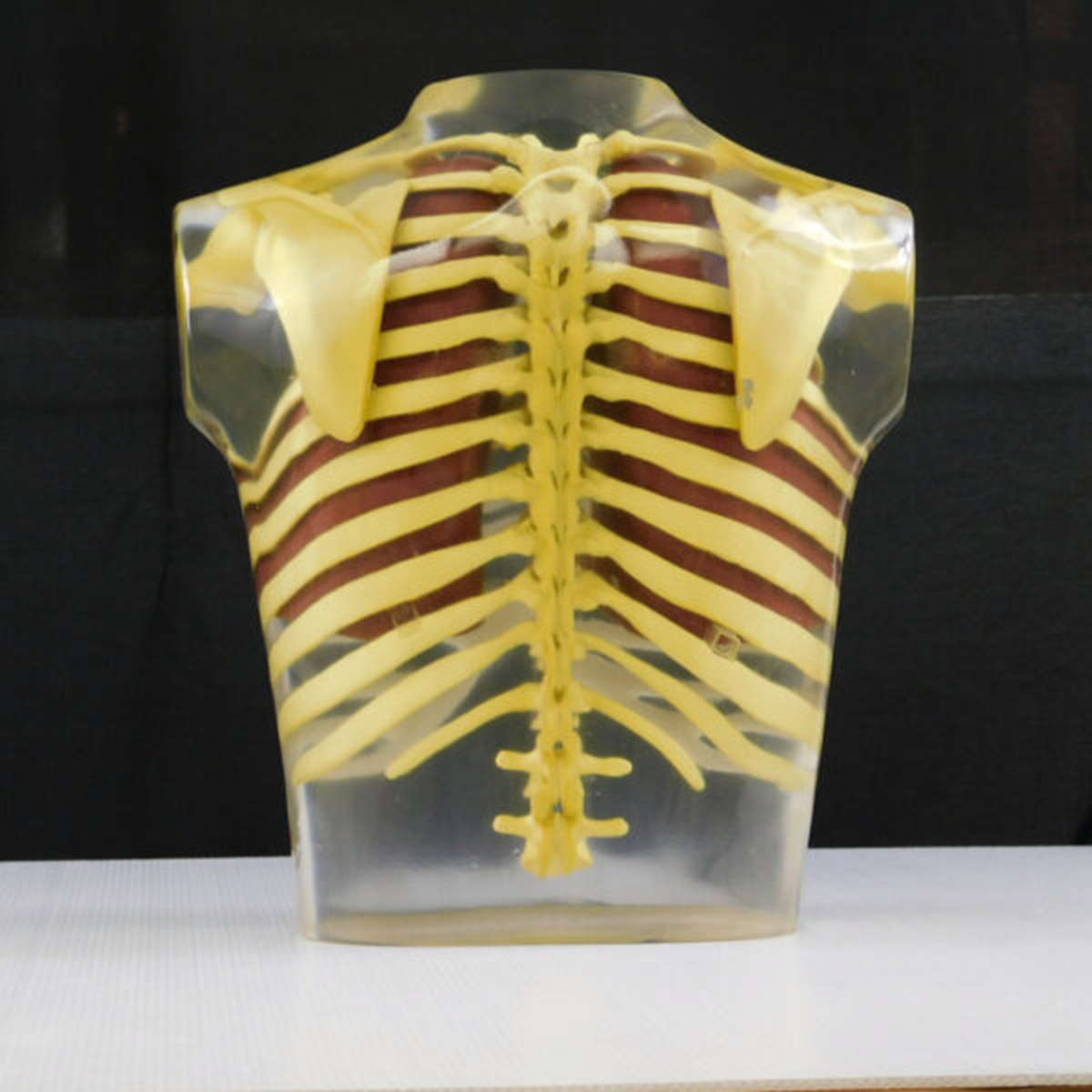 Phantom: Lungs-Thorax transparent — MTM - Médical Tronik